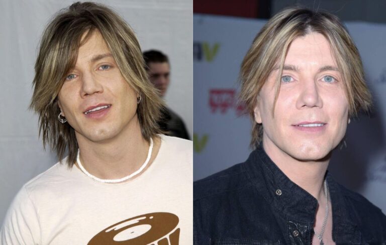 John Rzeznik Plastic Surgery: Goo Goo Dolls Lead Singer Plastic Surgery