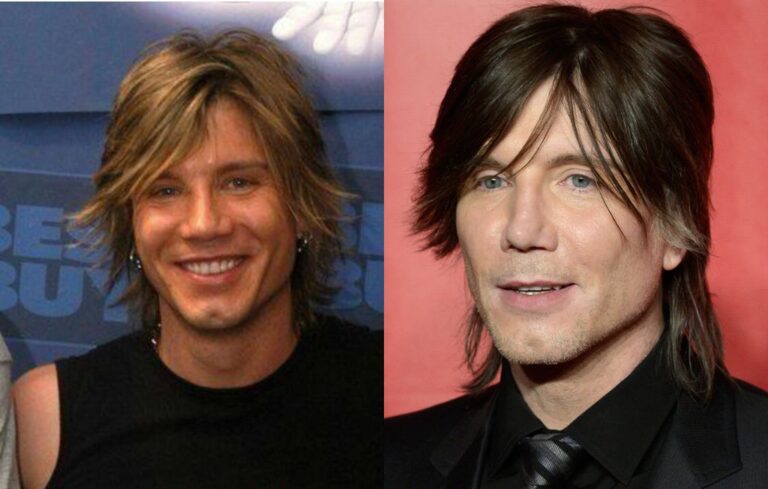 John Rzeznik Plastic Surgery: Goo Goo Dolls Lead Singer Plastic Surgery